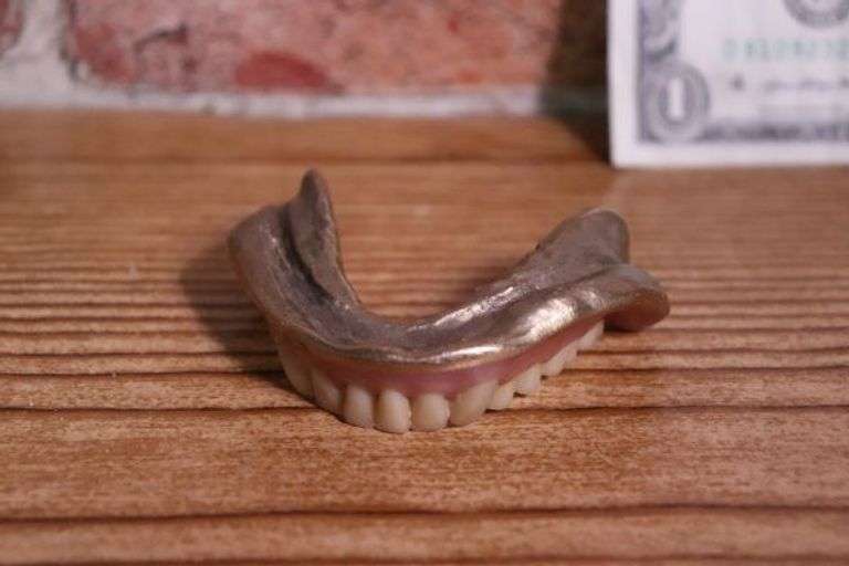RARE FIND! Vintage Upper Denture with GOLD Metal Inlay - Dental Gold ...